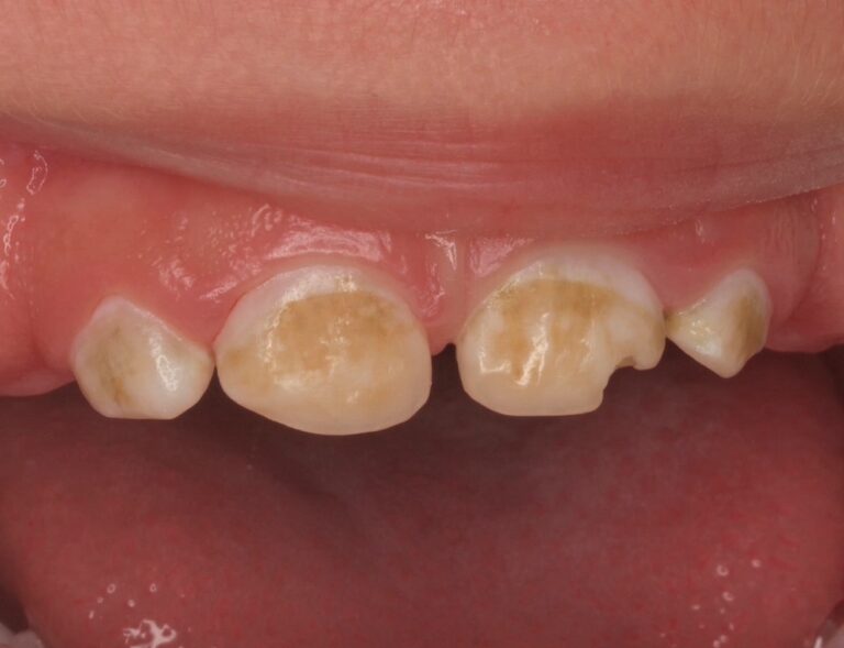 Eventos SPO – Eventos de la Sociedad Peruana de Odontopediatría